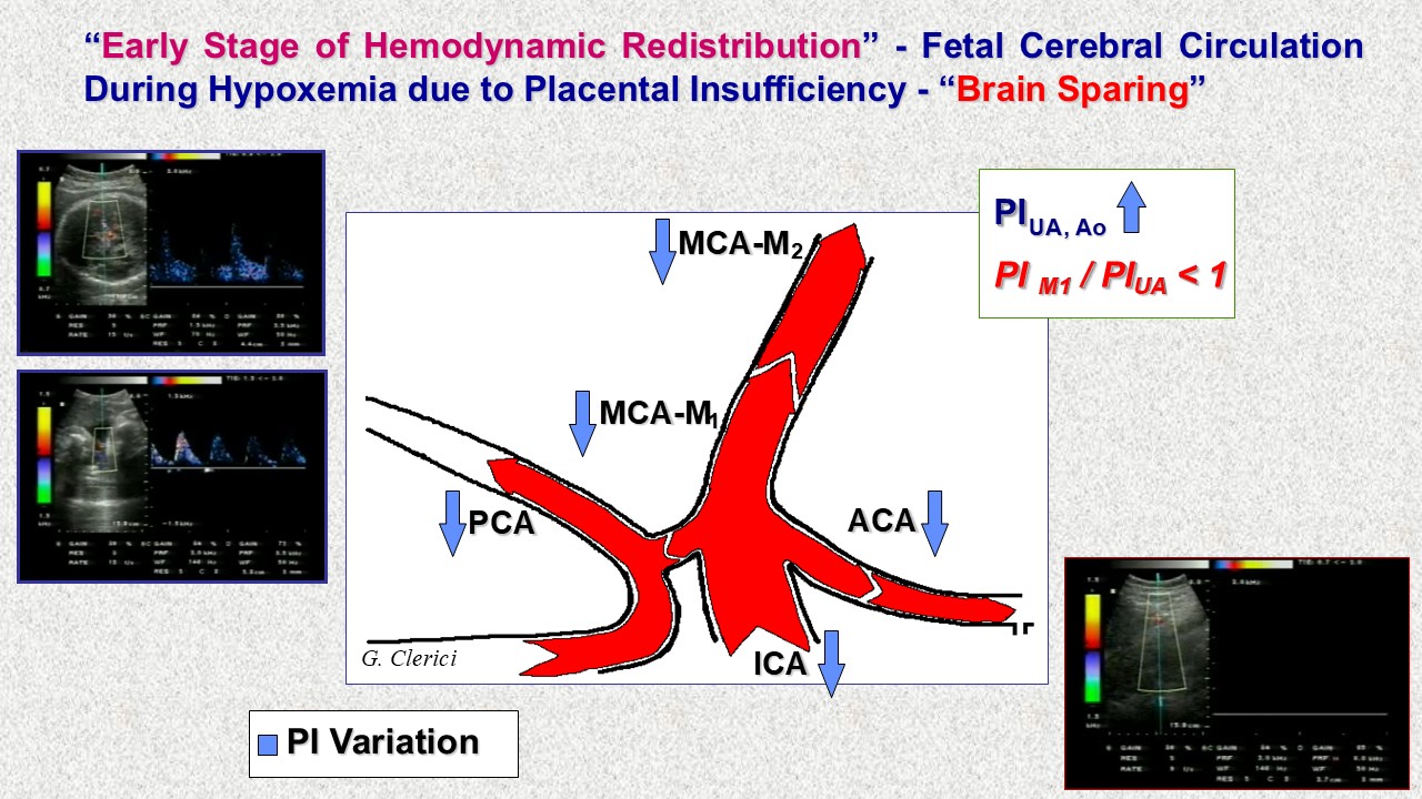 PSUOG - Permanent School of Ultrasound in Obstetrics & Gynecology